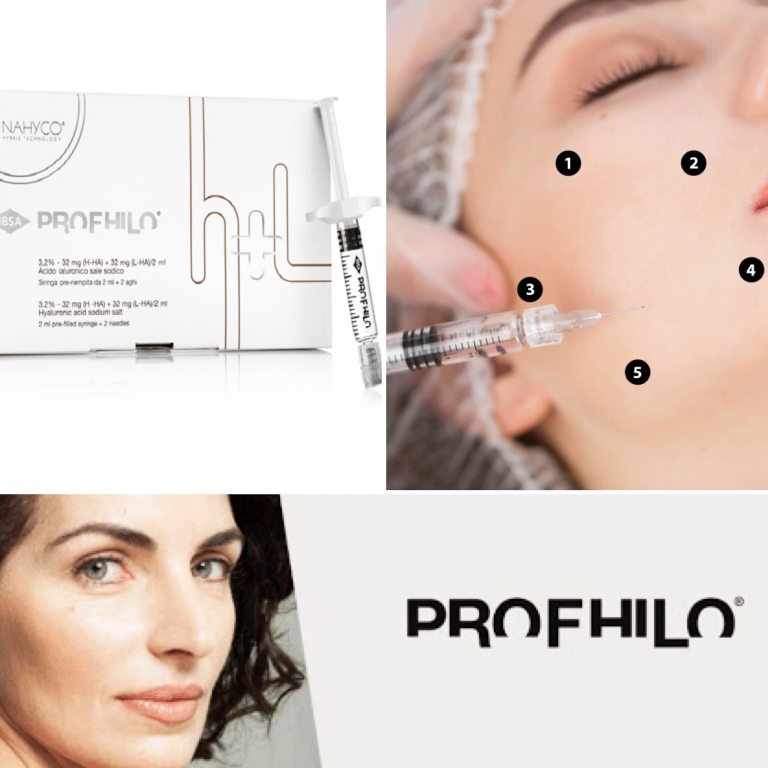 profhilo-arkiv - FaceBoost